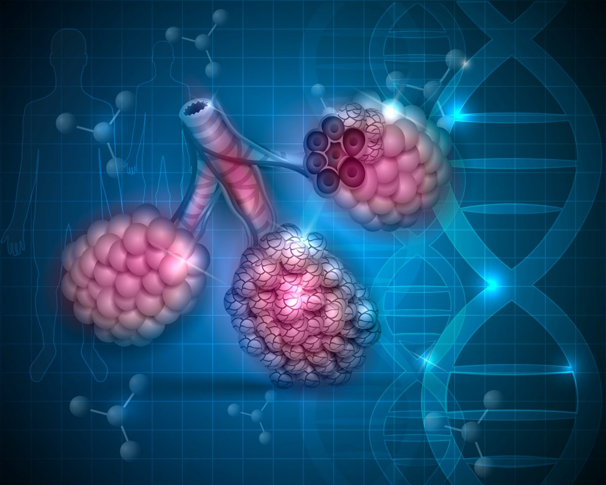 Gene Activity Analysis of IPF Lung Cells Pinpoints Abnormalities