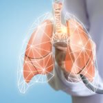 Explaining Clubbing of Fingers and Toes in Pulmonary Fibrosis ...