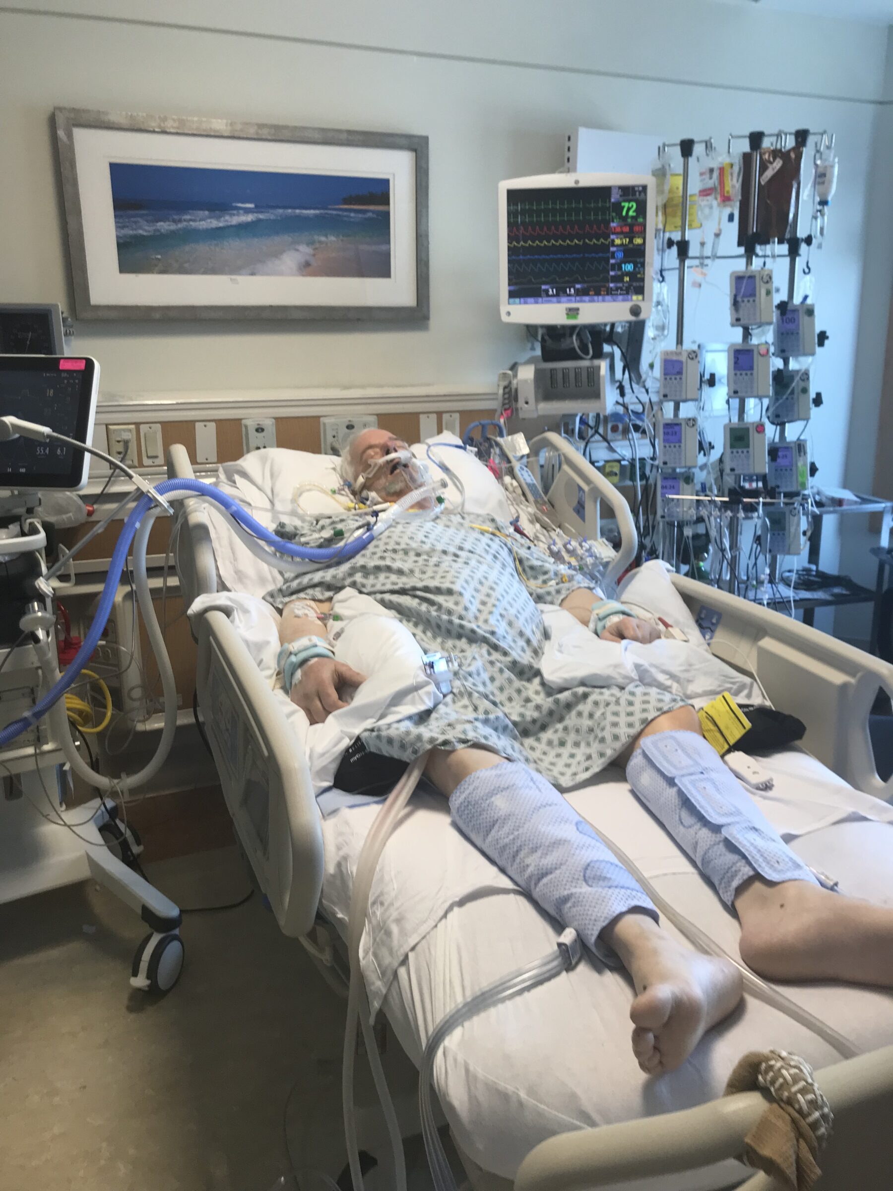 Lung transplant and pain meds: Oh, the things I saw! | Pulmonary ...